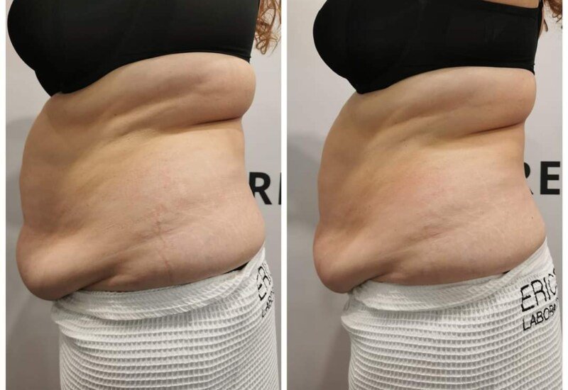 CRYOSKIN REVOLUTION - BeStetic Selection